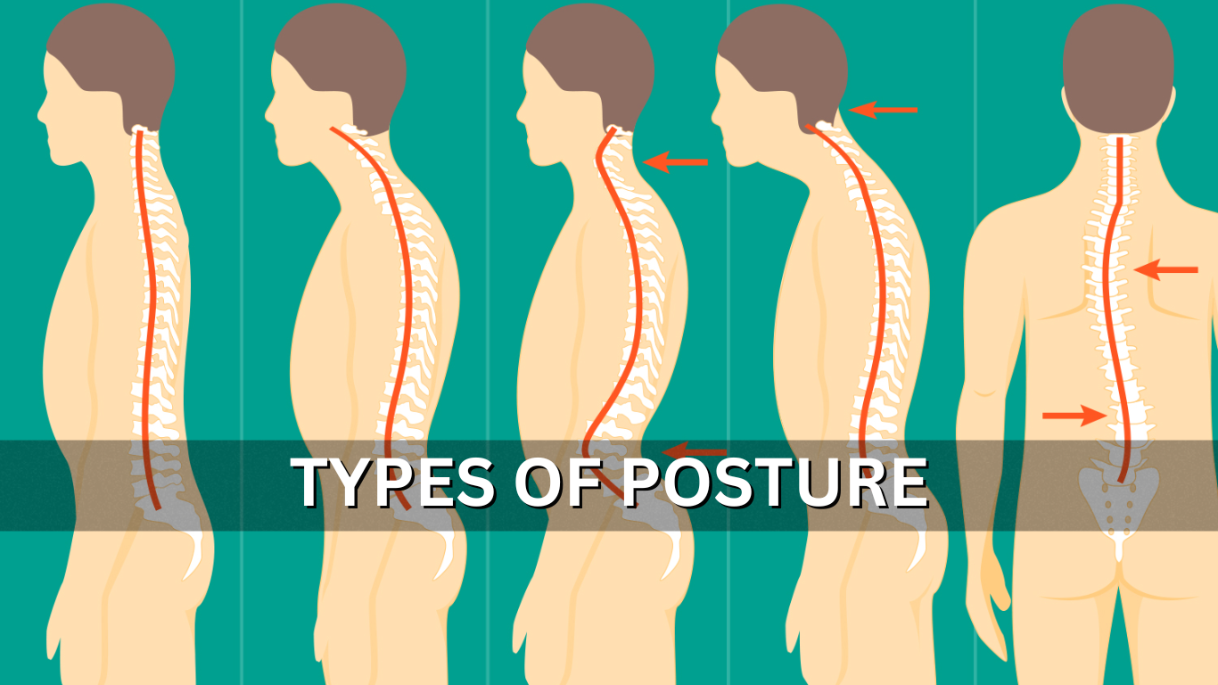 Types Of Posture. What Posture Leads To A Healthy Lifestyle